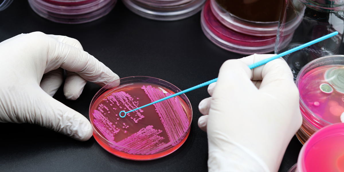 Urban Microbiome and Human Immunity: How City Life Shapes Your Gut and ...